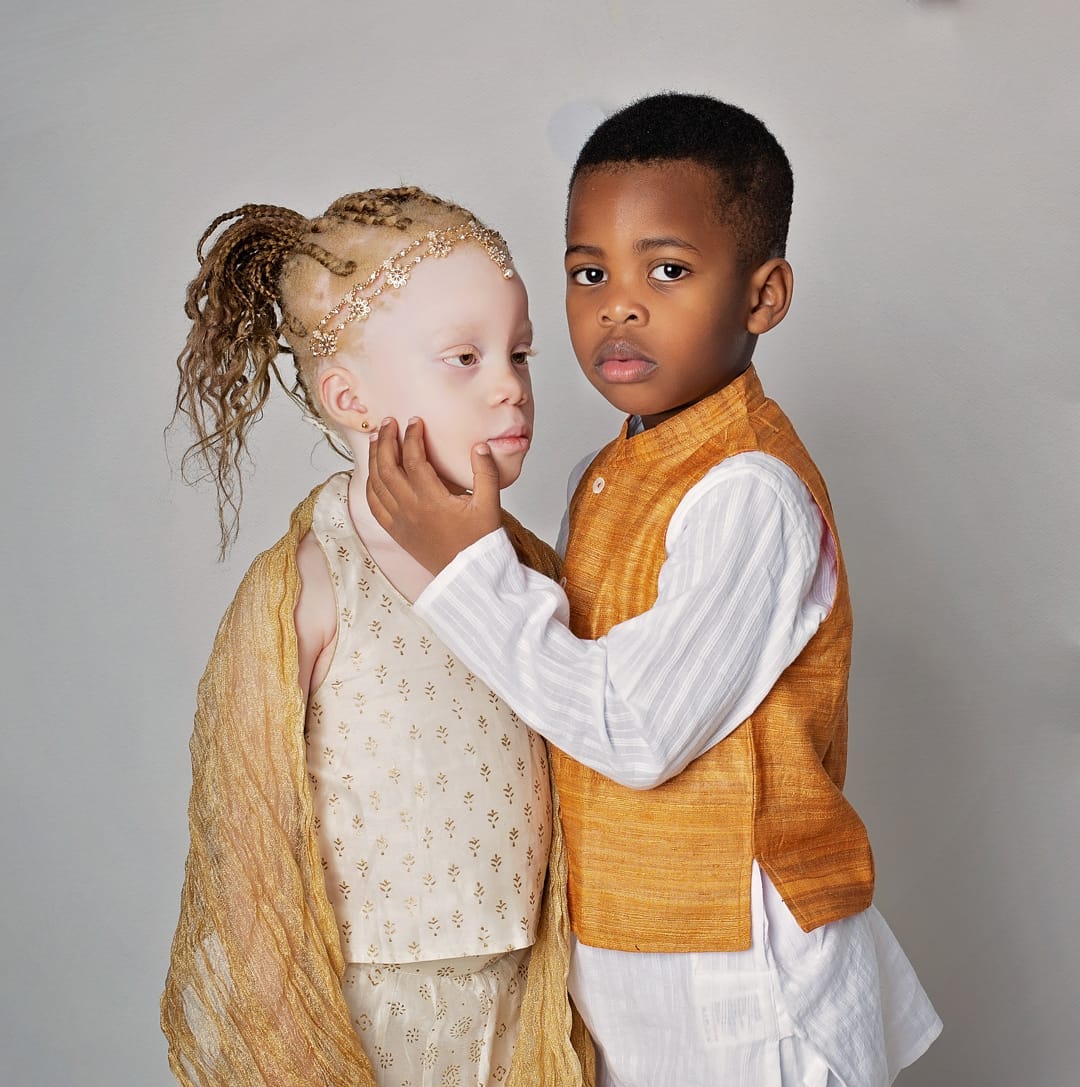 Baby With Albinism